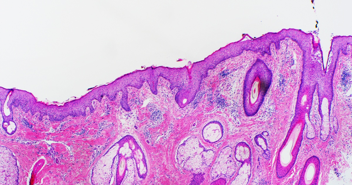 Deep Learning Enabled Scalable Calibration Of A Dynamically Deformed Multimode Fiber • Advanced